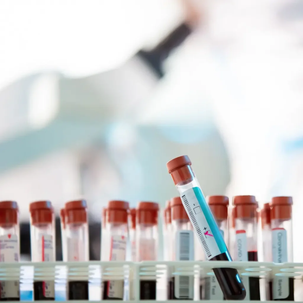 Lab Testing & Personalized Wellness Plans - Aestique Medispa